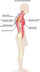 Latissimus Dorsi Pain Action Plan: Everything You Need To Know